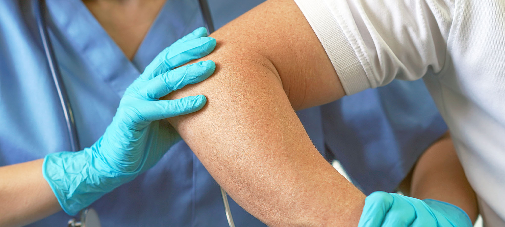 Tennisellenbogen - OCP Braunschweig